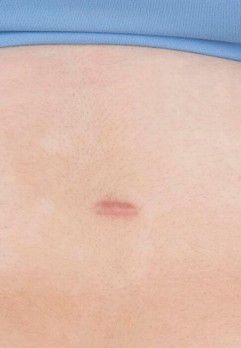 Real Results - Alliance Kelo Cote