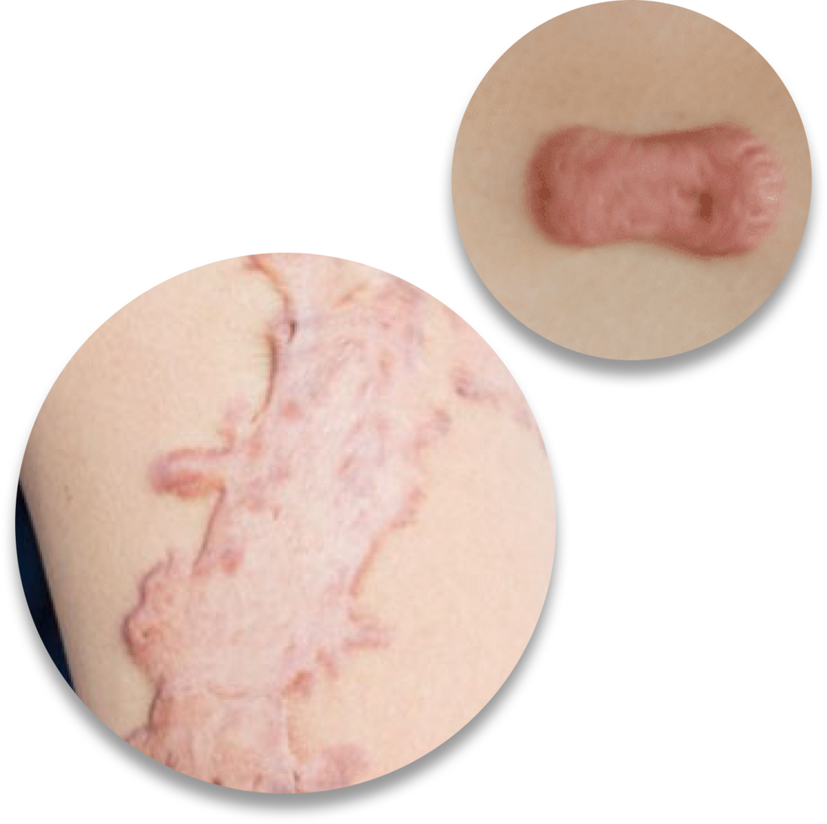 Scars - Alliance Kelo Cote